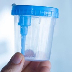 Como armazenar a amostra de urina e fezes?